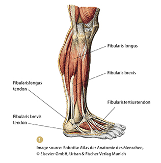 Fibularis Longus Tendon Diagnosis And Treatment Of Peroneal Tendon